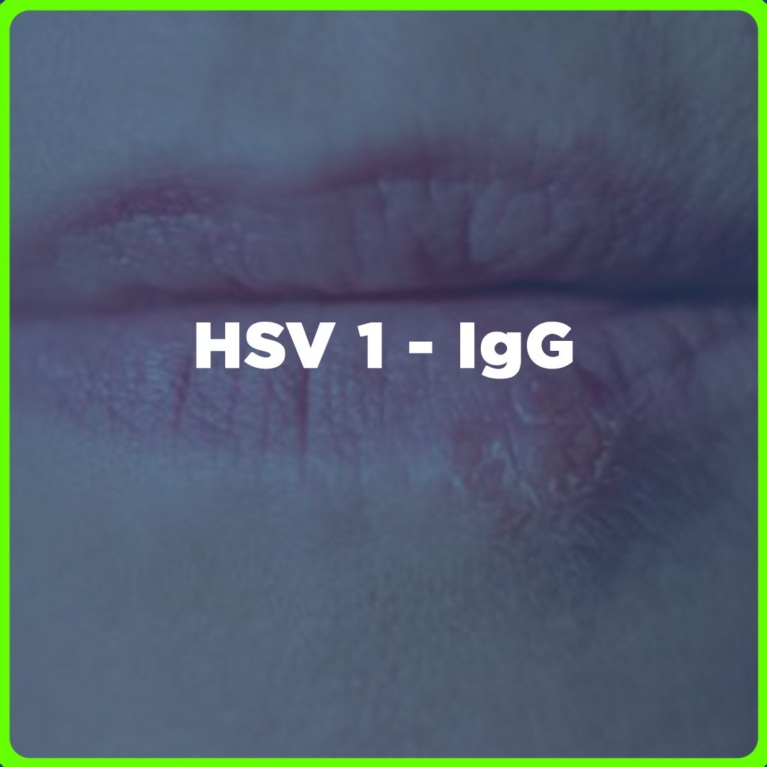 HSV 1 - IgG price in the Philippines | MedsGo Pharmacy
