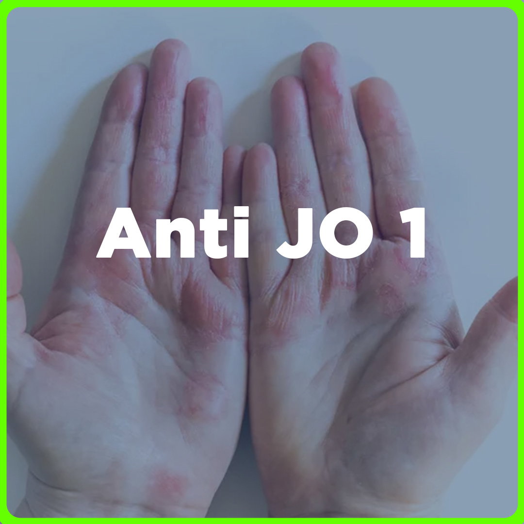 Anti JO 1 price in the Philippines | MedsGo Pharmacy
