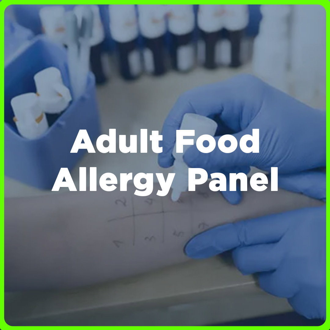 Adult Food Allergy Panel price in the Philippines | MedsGo Pharmacy